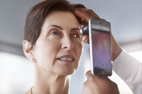 New Welch Allyn® PanOptic™ Plus Ophthalmoscope and Welch Allyn ...